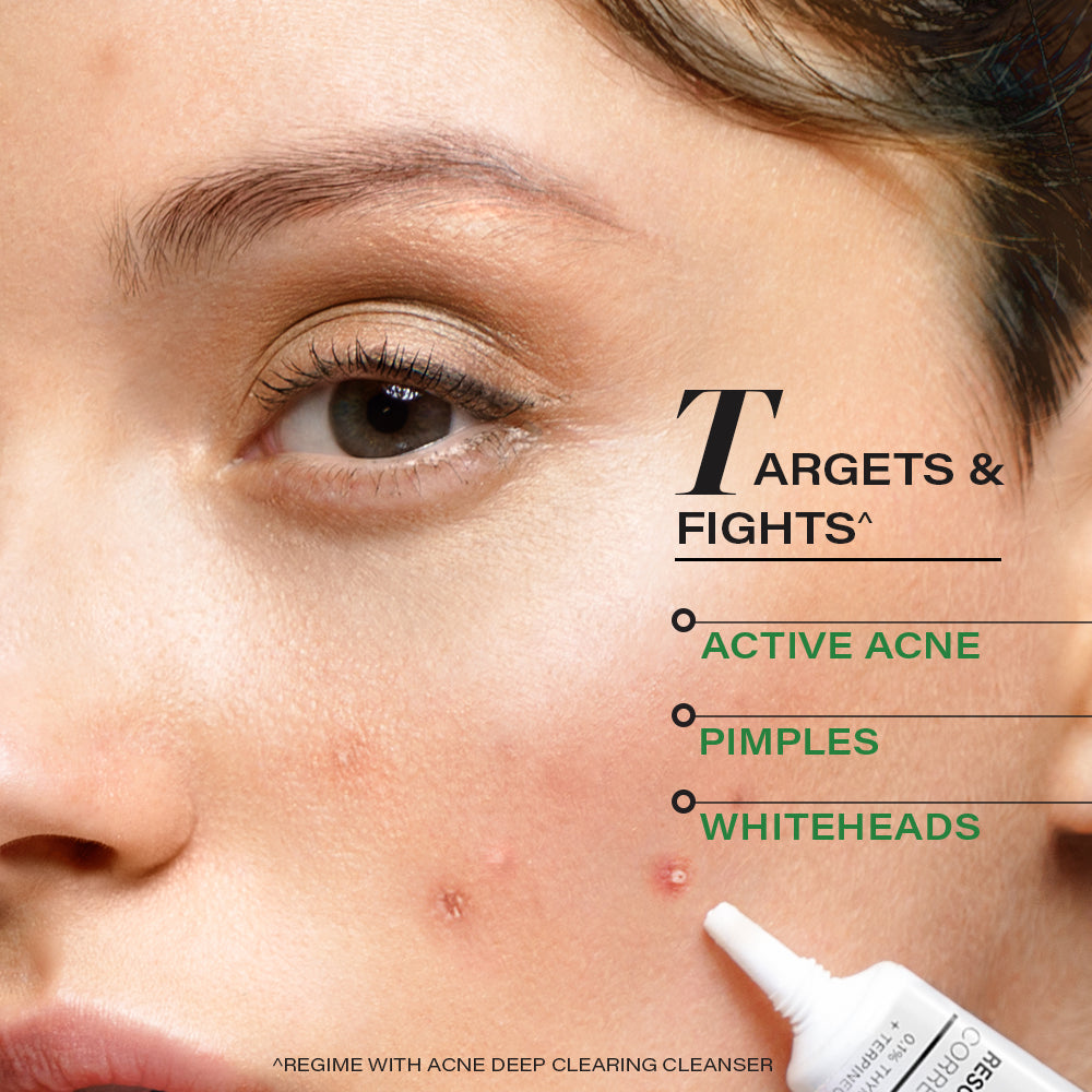 Buy Acne Spot Corrector Gel with Thympol & Terpineol | Novology