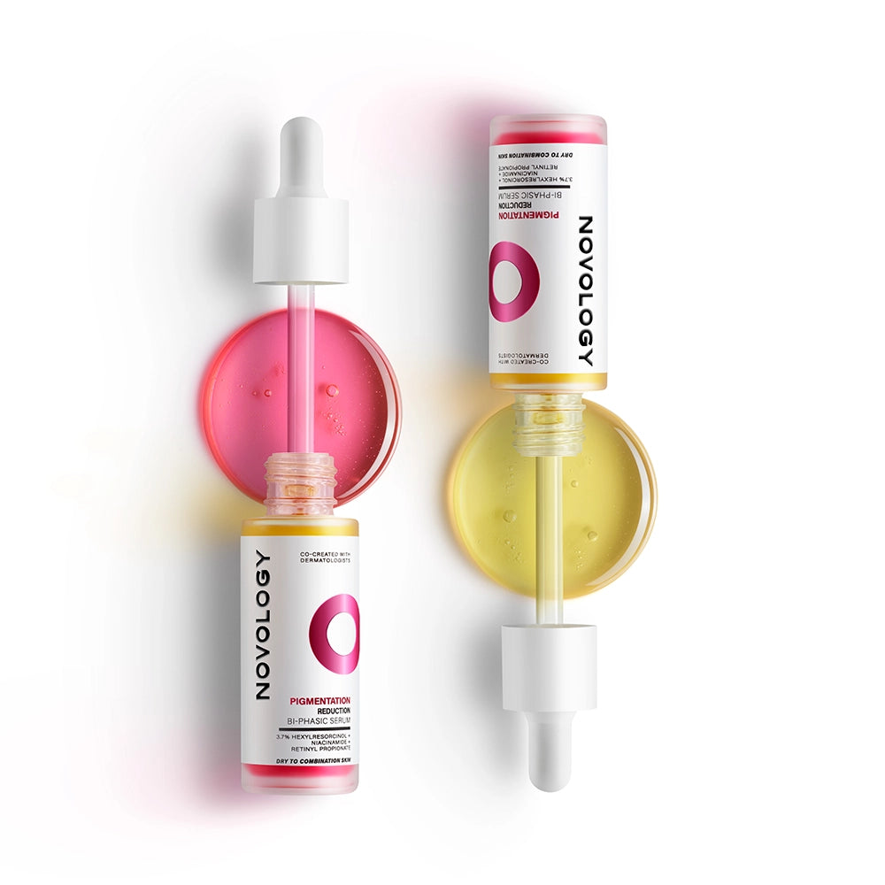 Hereditary Dark Circles - Genetic causes for dark circles explained ...