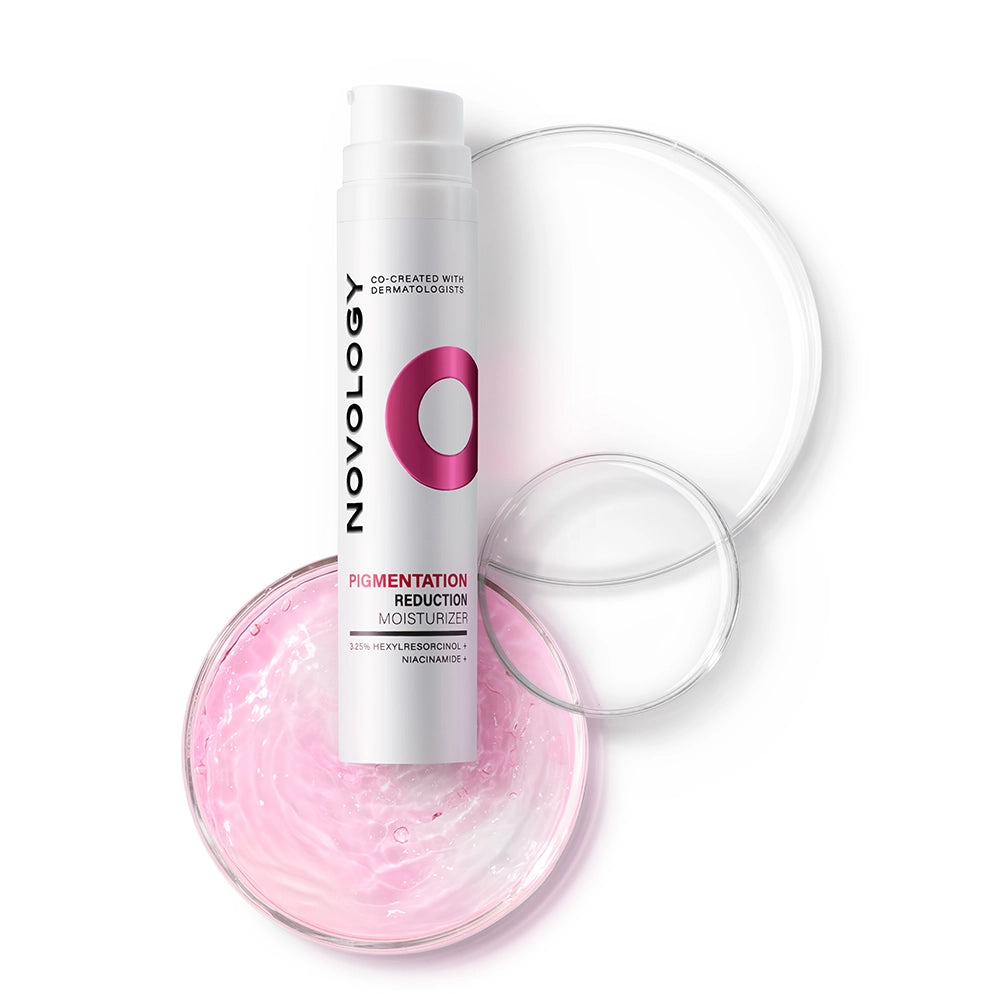 Hereditary Dark Circles - Genetic causes for dark circles explained ...